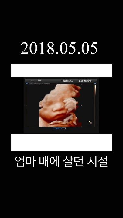 초음파 사진이랑 실제 모습 닮았을까 육아 초음파 아들 두살 Youtube
