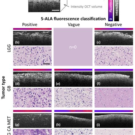The Architecture Of The Convolutional Neuronal Network Maxpooling2d 2d