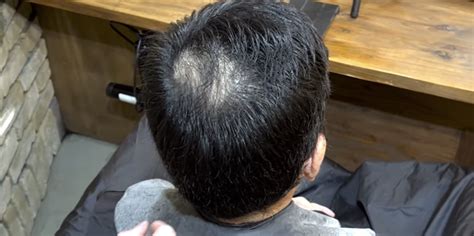 透ける頭頂部をカバーするヘアスタイル 薄毛に悩む男性の為の美容室ならRELIVE 薄毛に悩む男性のための完全個室美容室