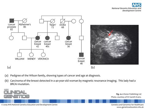 Explanation Slides Knudsons 2 Hit Hypothesis Ppt