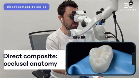 Direct Composite Occlusal Anatomy Youtube