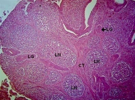Transverse Section Of The Caecal Tonsil At Day 112 Showing The Stroma Download Scientific