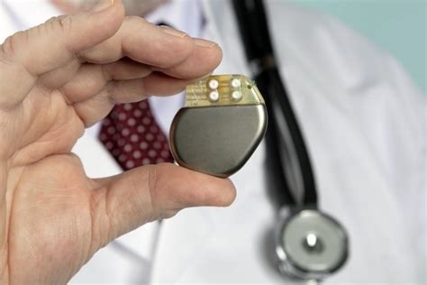 Could You Need A Pacemaker And Not Know It Vein Heart And Vascular