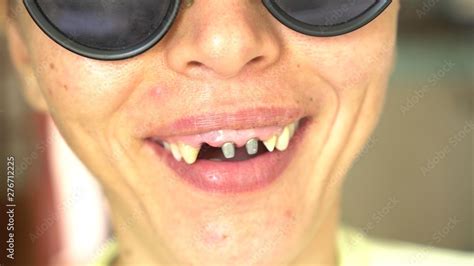 Ugly Smile Pictures