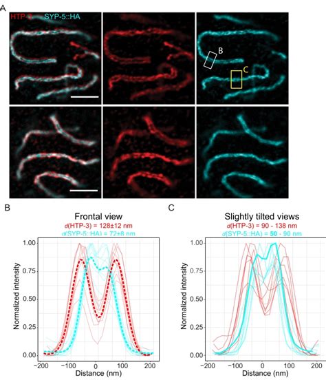 Super Resolution Microscopy Of The Synaptonemal Complex Within The