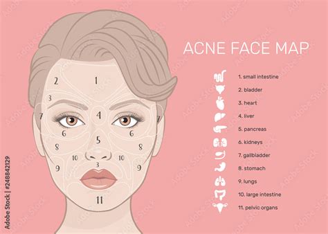 Acne Face Map Vector Illustration Of Beauty Woman Face Viscera
