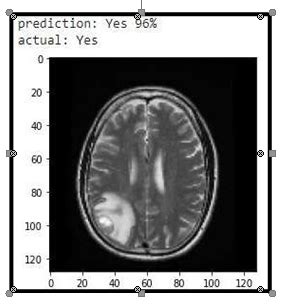 GitHub AHMEDSANA Binary Class Brain Tumor Classification In This We Trained A Model To Detect