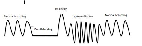 Breathing Pattern Disorders Physiopedia