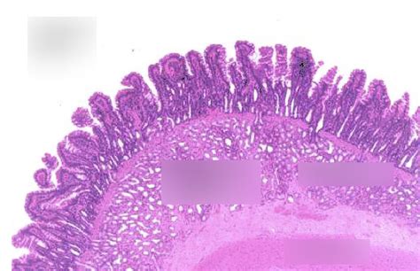 Duodenum Histology Diagram Quizlet
