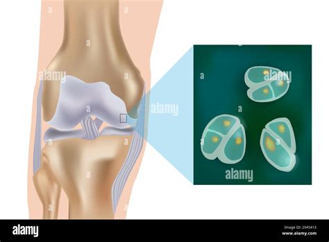Schematic Depiction Of Articular Cartilage And Chondrocytes Of The