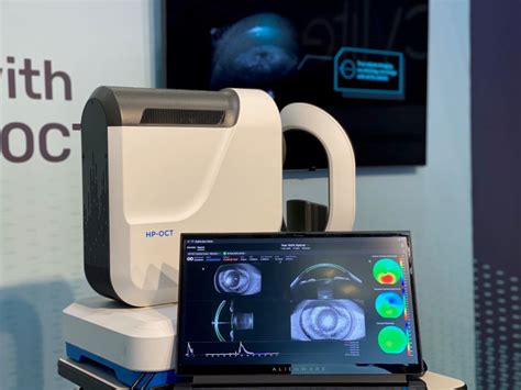 100optical Optometry Ophthalmology Eyehealth Myopiamanagement