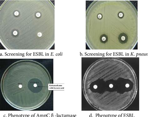 Figure 2 From The Status Of Extended Spectrum β Lactamase And Ampc β Lactamase Production In