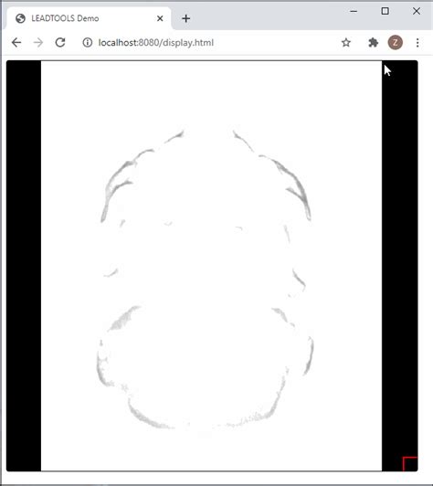 使用html查看dicom 使用leadtools html5 medical viewer从任何地方查看dicom图像教程 csdn博客