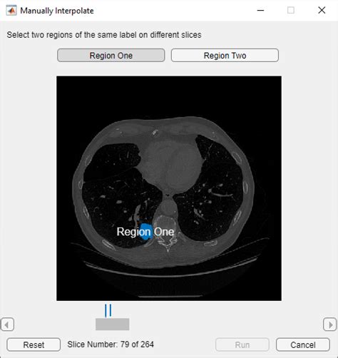 Label 3 D Medical Image Using Medical Image Labeler Matlab And Simulink
