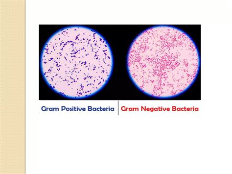 Identification Of Unknown Bacteria And Biochemical Testspptx