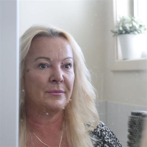 Lynette Smoje Stuck In Limbo As Tens Of Thousands Of Dollars Worth Of Dental Work Still