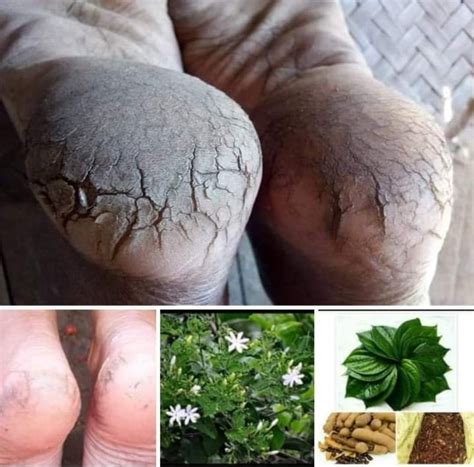 ပြန်လည် တိုင်းရင်းဆေးပညာအကြောင်း သိကောင်းစရာ