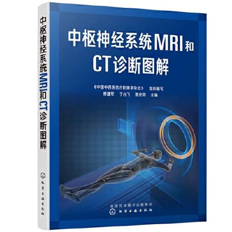 中枢神经系统mri和ct诊断图解 百度百科