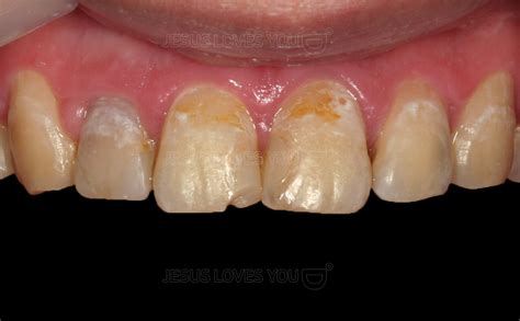 하루에 치료하는 치과 하루에치과