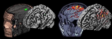 Inverse Modeling The Localization A Vs Imaging B Approaches Download Scientific Diagram