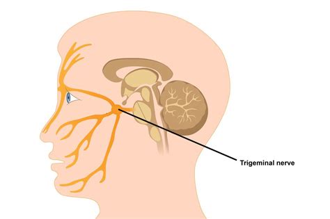 Best Trigeminal Neuralgia Doctors In Bangalore