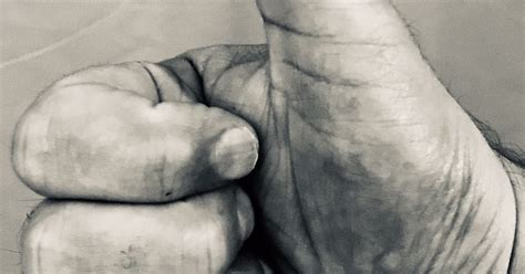 An Open Source Developer Gave A Best In Class Answer To My Bug Report