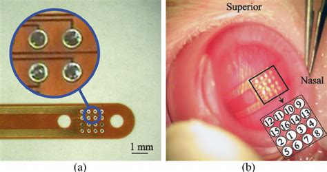 Photographs Of Mems Based Microelectrode Array And Rabbit Fundus After Download Scientific