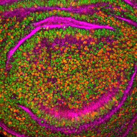 Polypeptide Vs Protein Difference And Comparison