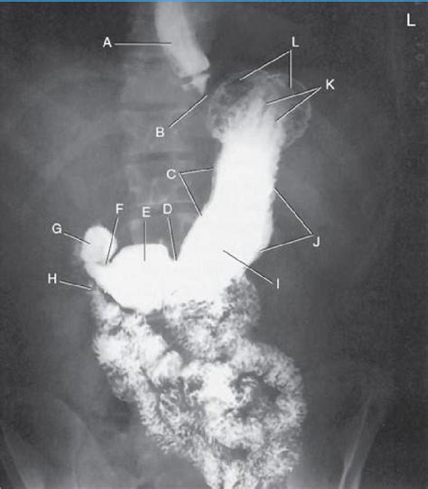 Git 1 Diagram Quizlet