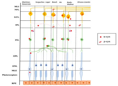 The Role Of Alpha Synuclein Deposits In Parkinsons Disease A Focus On