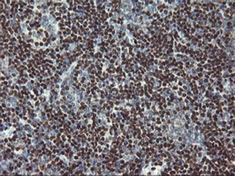 Mef2c Mouse Anti Human Clone Oti1d1 Lyophilized Truemab™ 100 μg