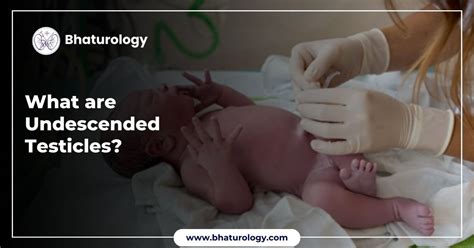 What Are Undescended Testicles
