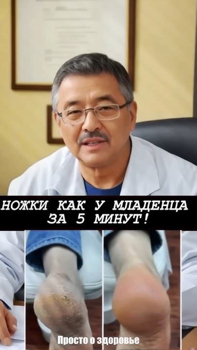 Спасение для ног Чудо мазь творит чудеса Youtube