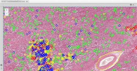 How To Handle Hundreds Of Thousands Of Annotations Real Data Digital Pathology Blog