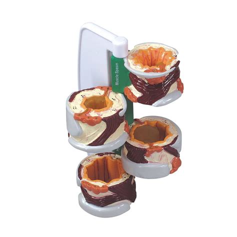 4 Piece Bronchus Anatomy Model