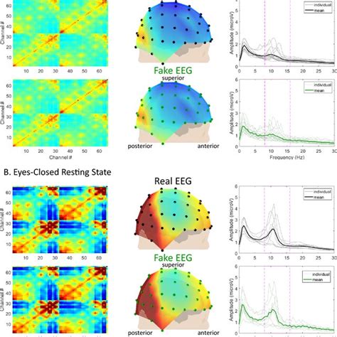 Examples Of Eye Open A And Eyes Closed B Resting State Eeg For