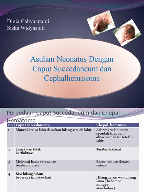 Chepal Hematom Pptx Pdf