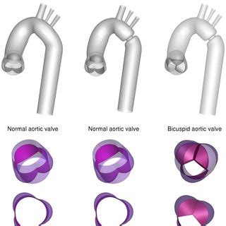 Pulsatile Flow Rate Waveform Used As Inlet Condition For The Numerical Download Scientific