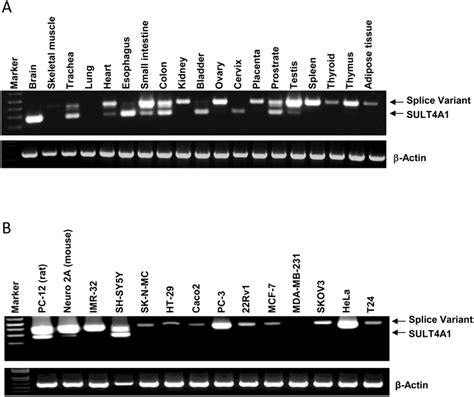 Expression Of Sult4a1 Transcripts In Human Tissues And Cells A Mrna Download High