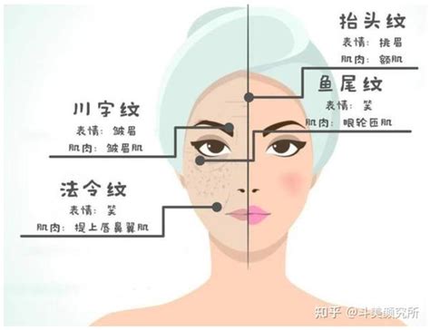 面部颜值“纹”题 静态纹和动态纹傻傻分不清楚？这篇文章帮你轻松搞定！ 知乎