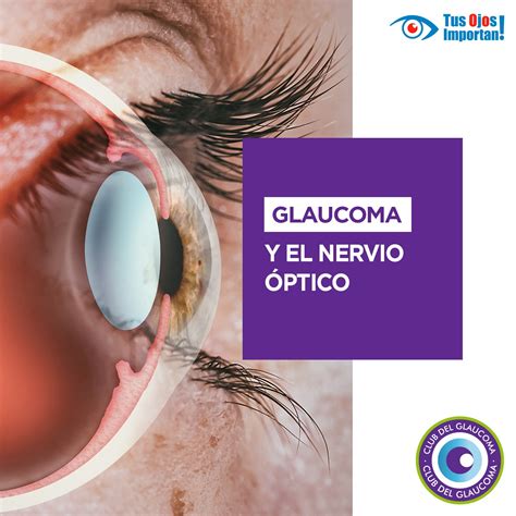 El Nervio óptico Es La Parte Del El Club Del Glaucoma