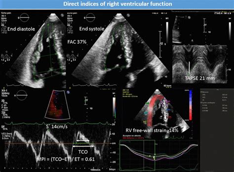 What Is A Normal Tapse At Antonio Baker Blog