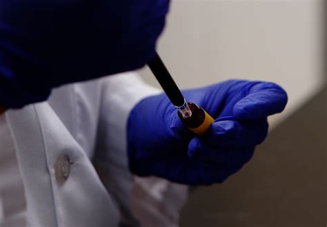 Sample Testing Peanut Ppm Neogen