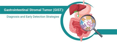 Gastrointestinal Stromal Tumor Gist Diagnosis And Early Detection Strategies