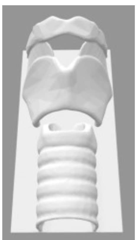 The Model Can Be Re Created By Downloading The Model For 3 D Printing