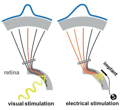 Improvement In The Resolution Of Retinal Prostheses Electronics Lab