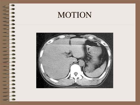 Ppt Artifacts In Computed Tomography Powerpoint Presentation Free Download Id6595912