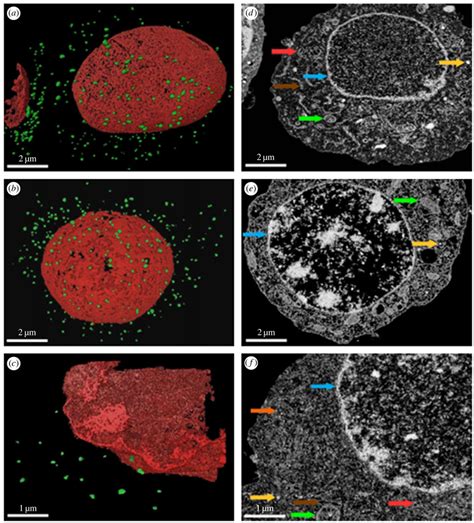 FIB SEM microscopy images of the segmented examined β cells Images a Download Scientific