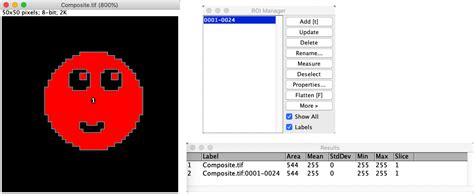 Imagej Thresholding — Introduction To Bioimage Analysis
