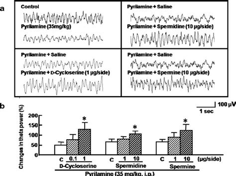 Effects Of Nmda Receptor Agonists On Hippocampal Theta Activity During Download Scientific